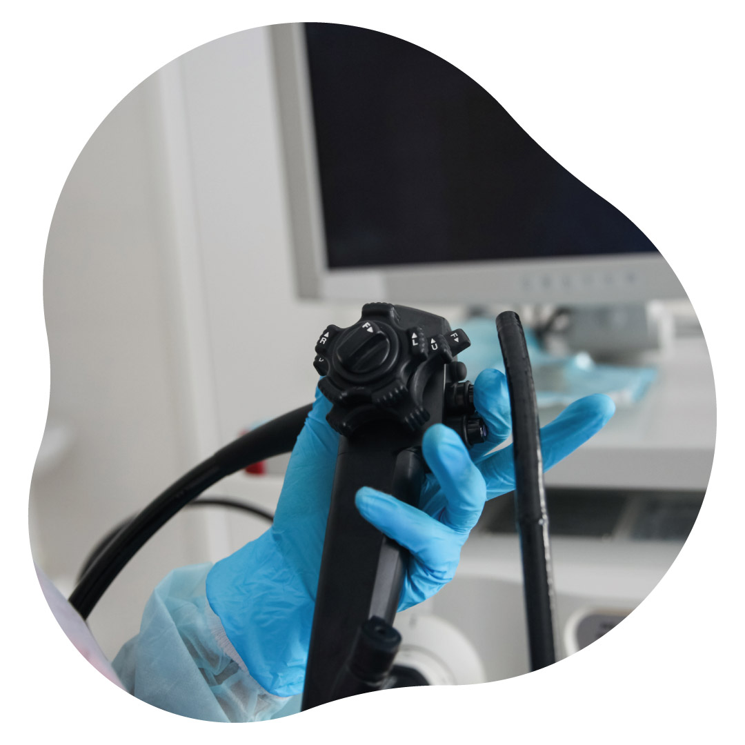 Endoscopia Vila Velha - Ezmedi